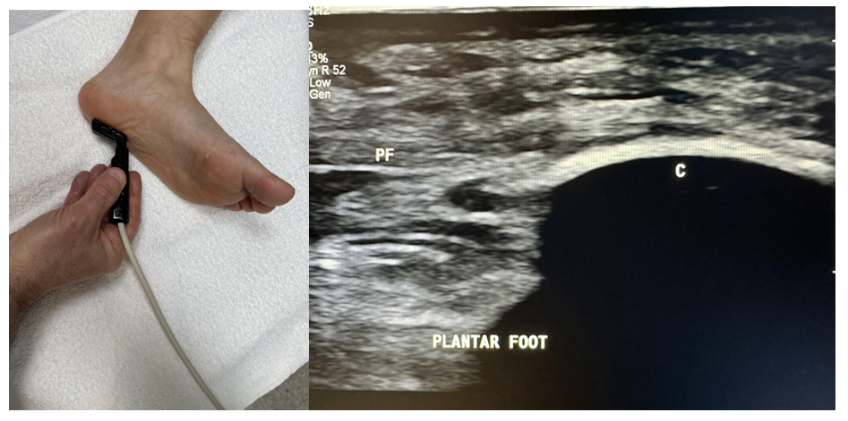 Musculoskeletal Sonography Ultrasound Physics And Its Application In